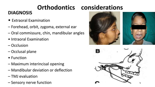 Distraction osteogenesis in orthodontics -Dr.G V SHETTY | PPTX | Bone ...