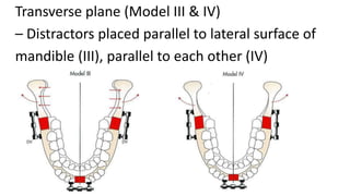Distraction osteogenesis in orthodontics -Dr.G V SHETTY | PPTX