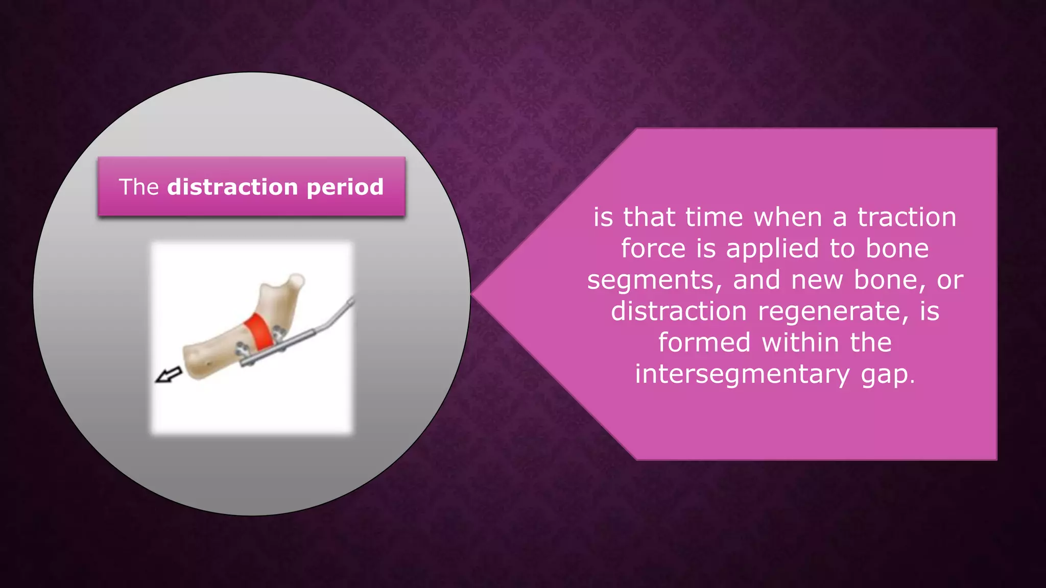 Distraction osteogenesis in maxillofacial surgery | PPTX