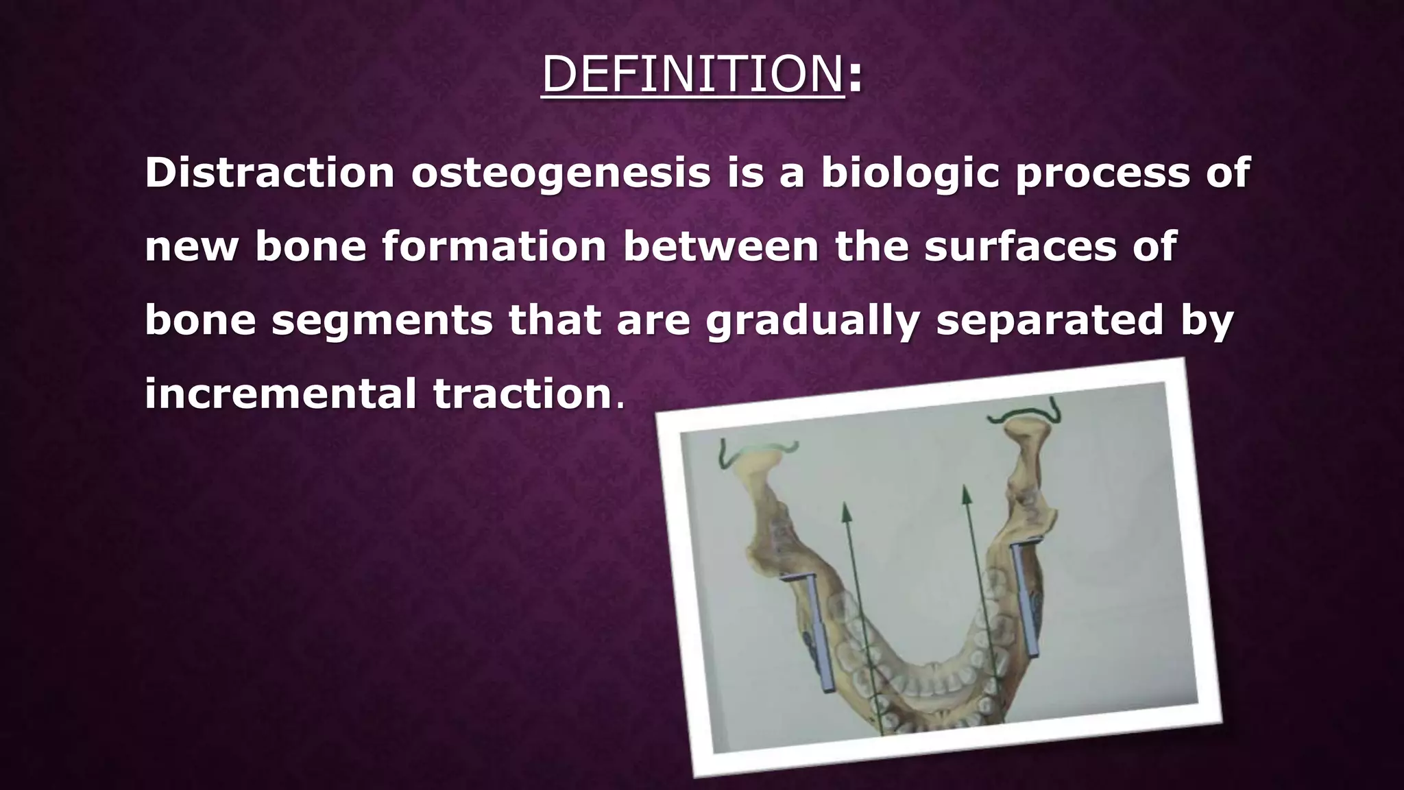 Distraction osteogenesis in maxillofacial surgery | PPTX