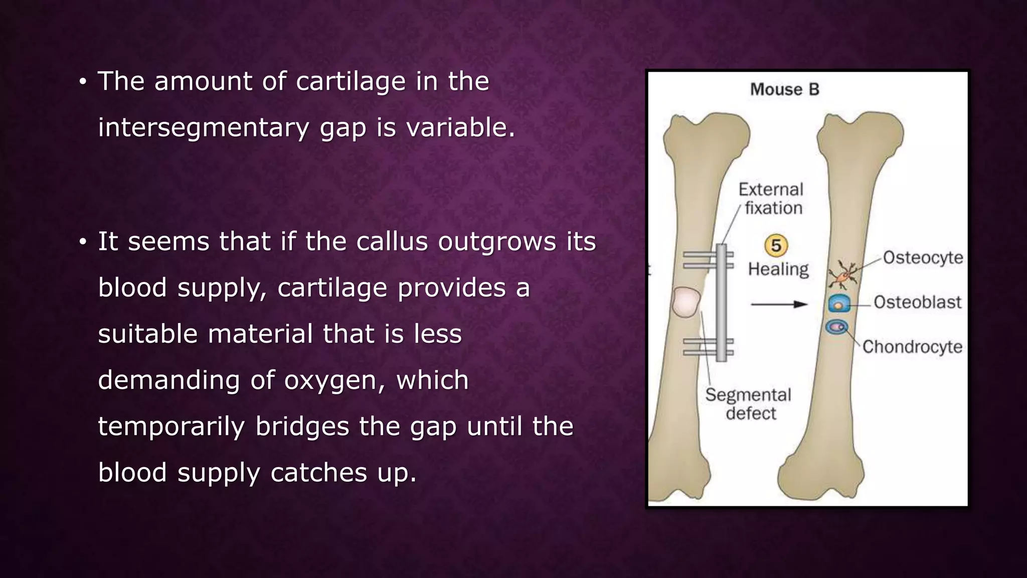 Distraction osteogenesis in maxillofacial surgery | PPTX
