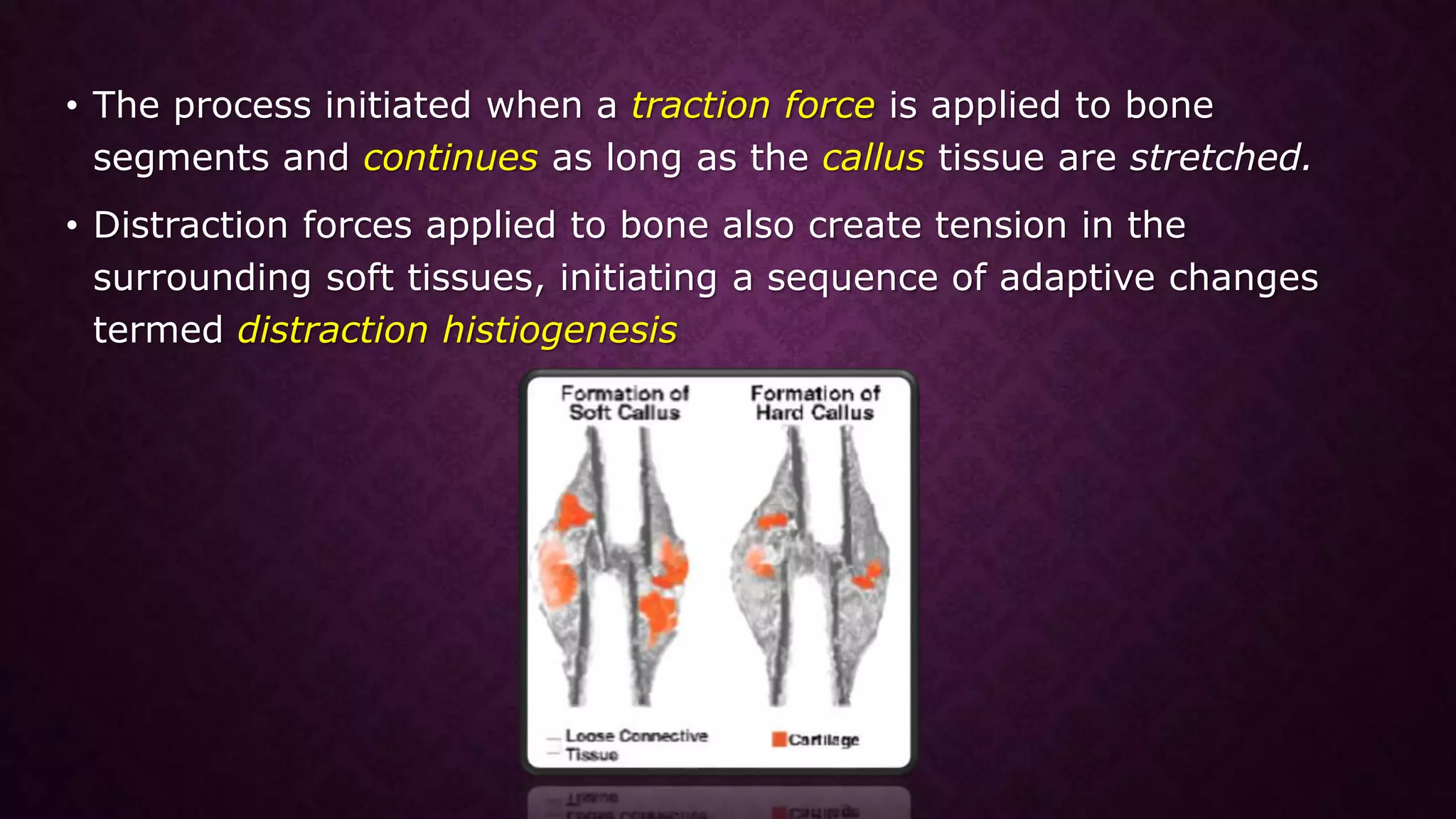 Distraction osteogenesis in maxillofacial surgery | PPTX