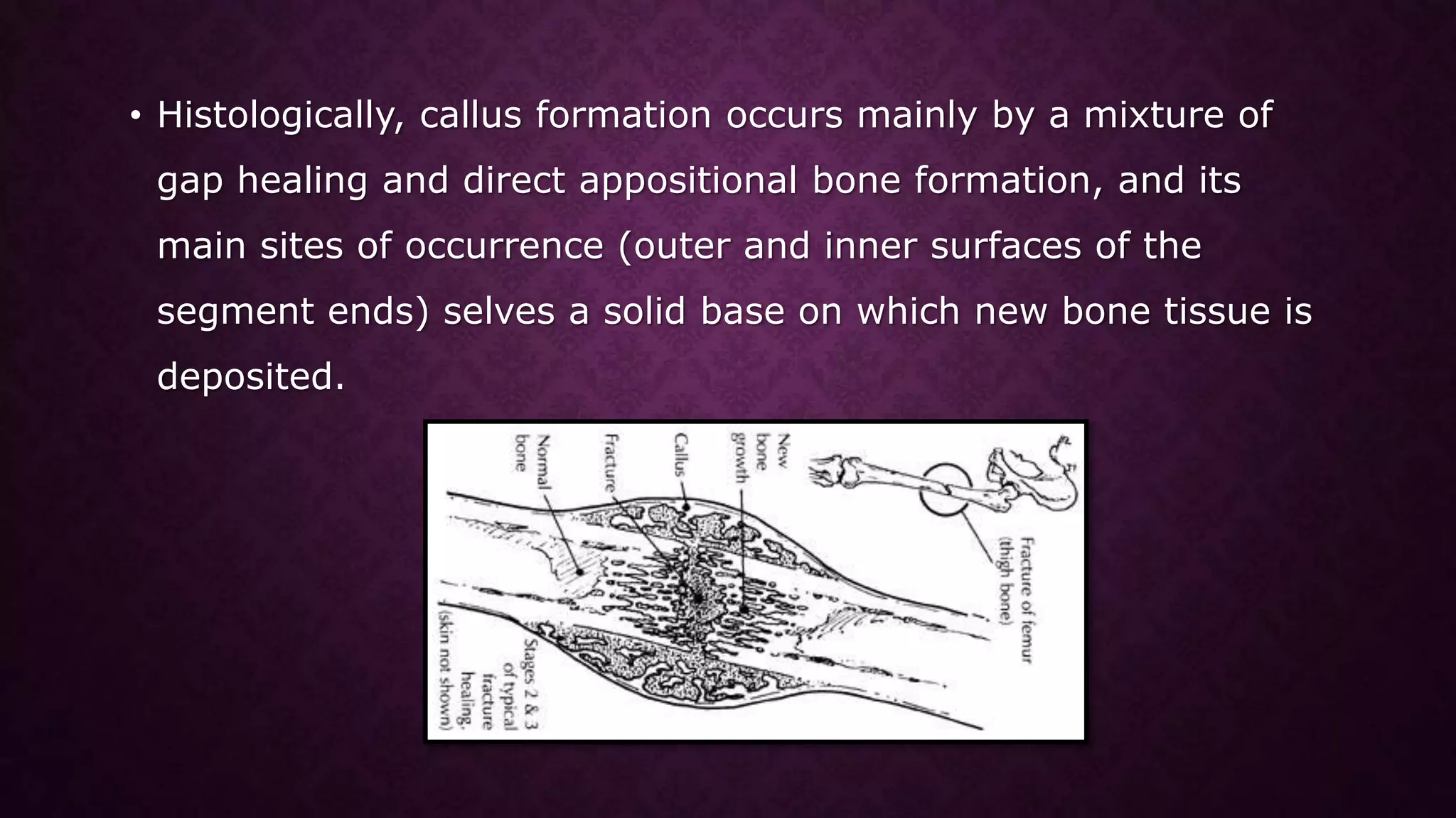 Distraction osteogenesis in maxillofacial surgery | PPTX
