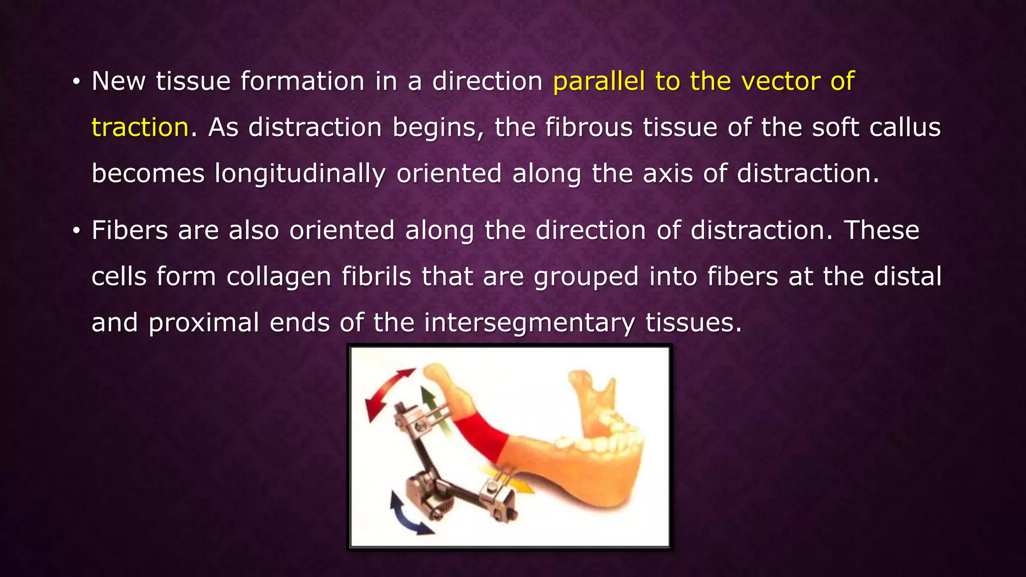 Distraction osteogenesis in maxillofacial surgery | PPTX