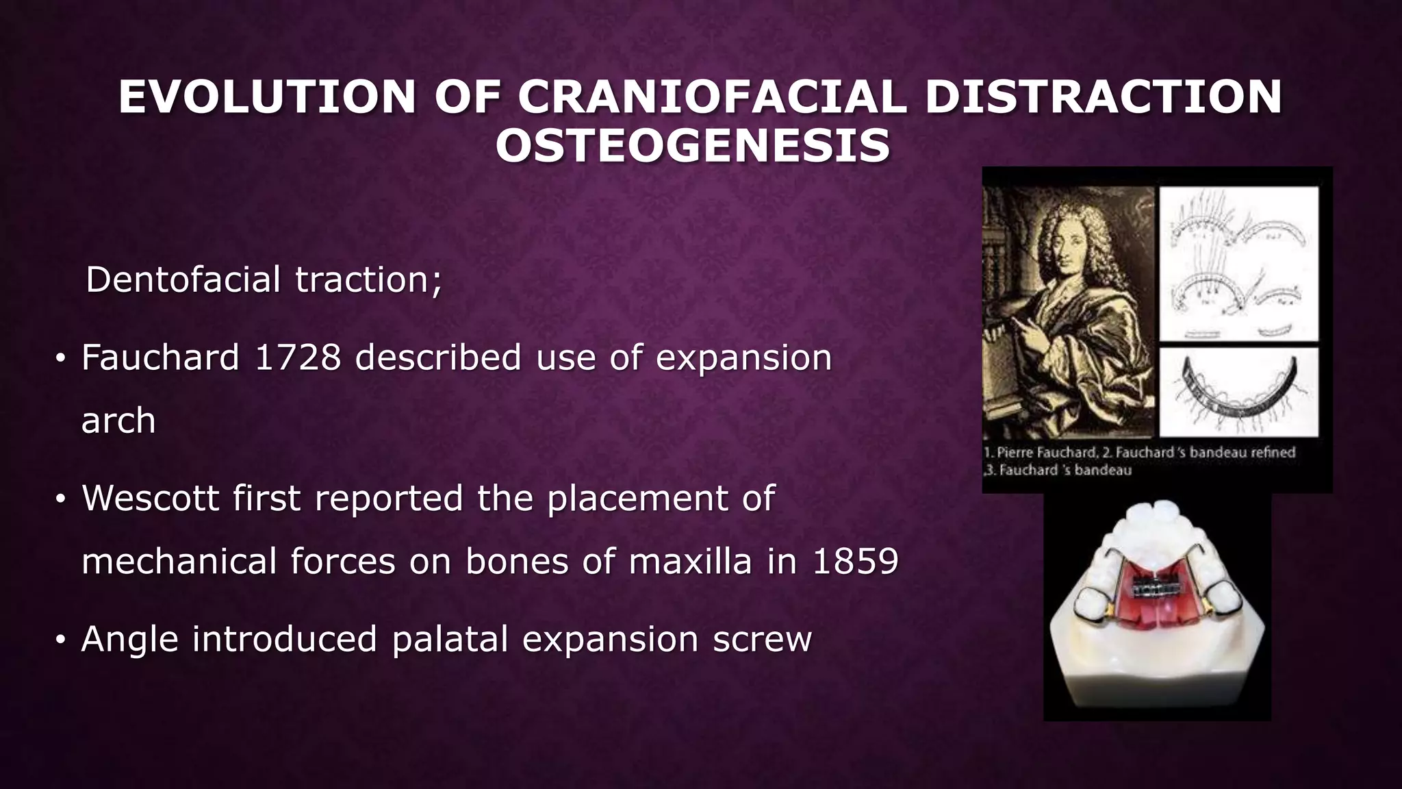 Distraction osteogenesis in maxillofacial surgery | PPTX