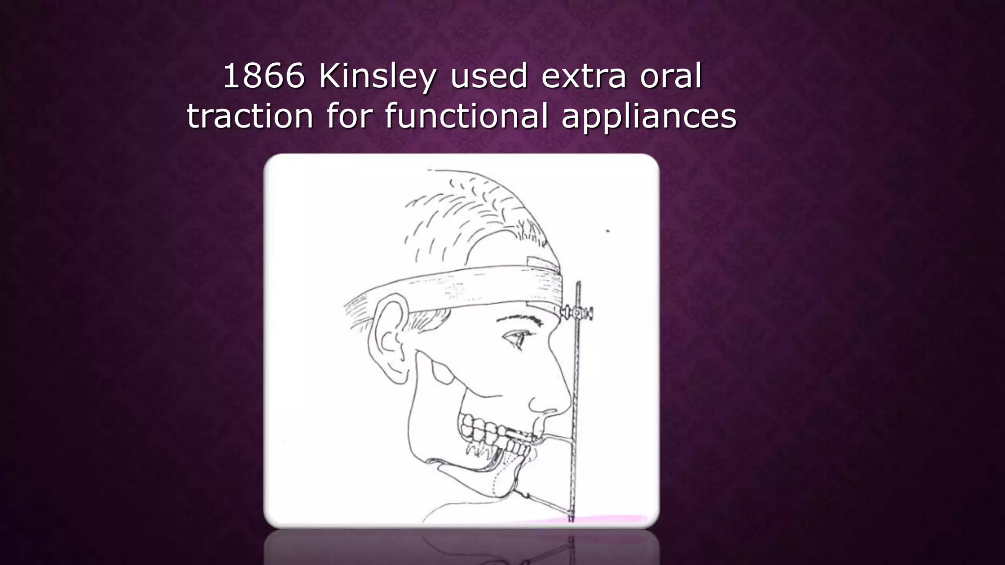 Distraction osteogenesis in maxillofacial surgery | PPTX