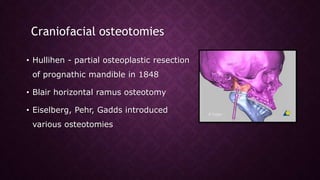 Distraction osteogenesis in maxillofacial surgery | PPTX