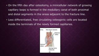 Distraction osteogenesis in maxillofacial surgery | PPTX