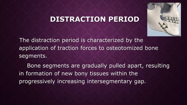 Distraction osteogenesis in maxillofacial surgery | PPTX
