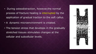 Distraction osteogenesis in maxillofacial surgery | PPTX