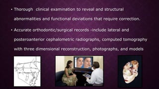 Distraction osteogenesis in maxillofacial surgery | PPTX