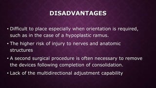 Distraction osteogenesis in maxillofacial surgery | PPTX