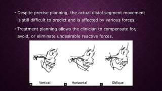 Distraction osteogenesis in maxillofacial surgery | PPTX
