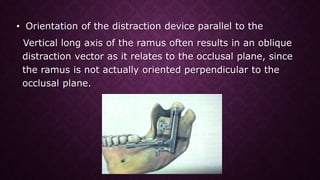 Distraction osteogenesis in maxillofacial surgery | PPTX