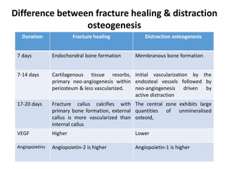 Distraction Osteogenesis of Facial bones | PPT