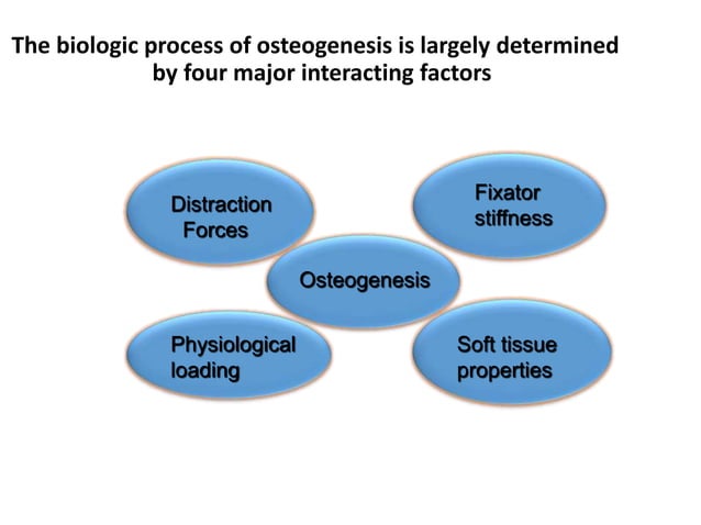 Distraction Osteogenesis of Facial bones | PPT