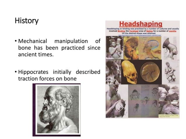 Distraction Osteogenesis of Facial bones | PPT