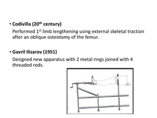 Distraction Osteogenesis of Facial bones | PPT