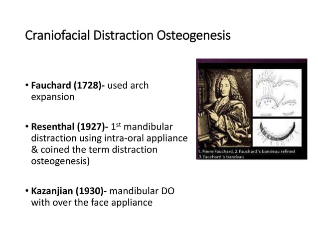 Distraction Osteogenesis of Facial bones | PPT