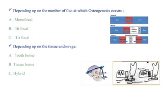 Distraction Osteogenesis new orthodontics.pptx