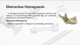 Distraction Osteogenesis new orthodontics.pptx
