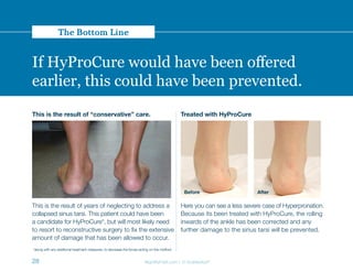 Myths and Misconceptions of HyProCure | PPT