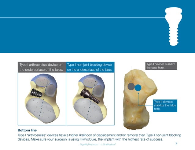 Myths and Misconceptions of HyProCure | PPT