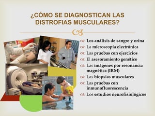 ¿Cómo Se Diagnostica La Distrofia Muscular ? – FDOMF