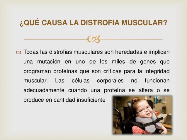 Distrofia muscular