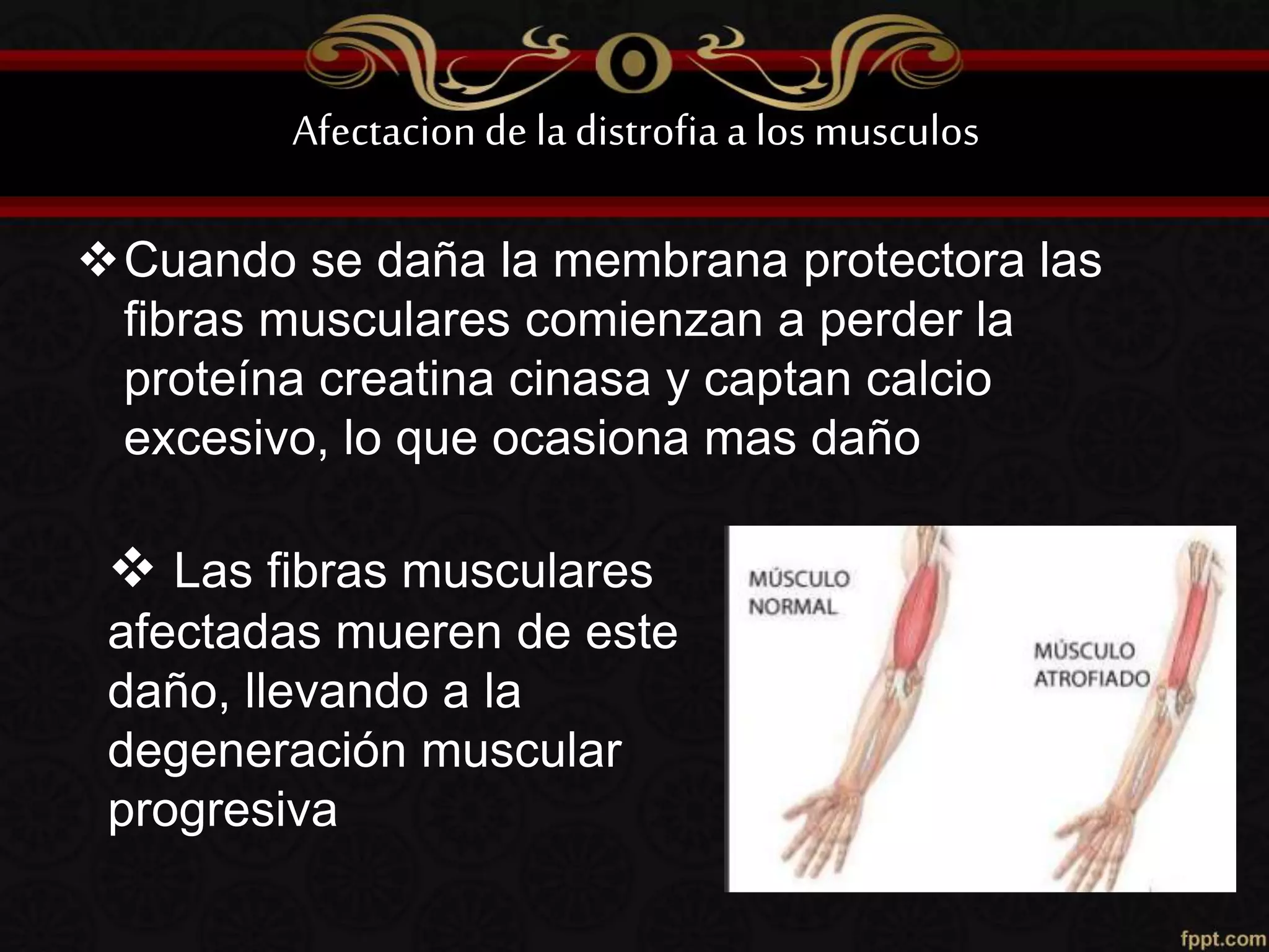 Distrofia muscular | PPTX