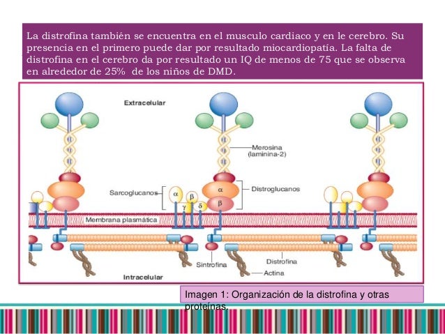 Distrofia muscular de duchenne