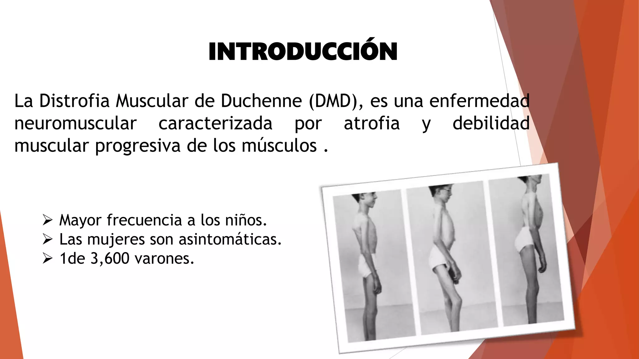 Distrofia muscular de duchenne | PPTX