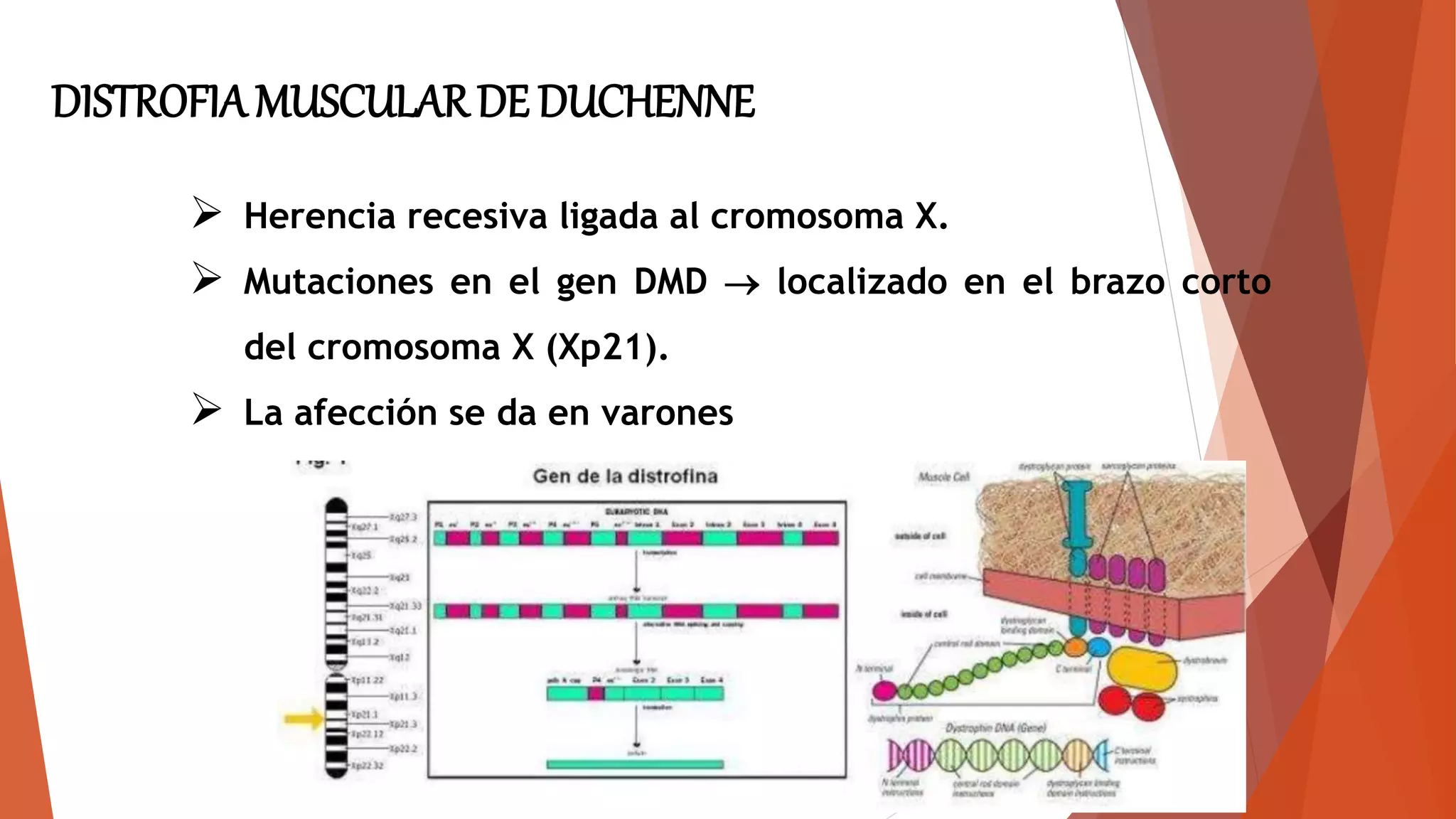 Distrofia muscular de duchenne | PPTX