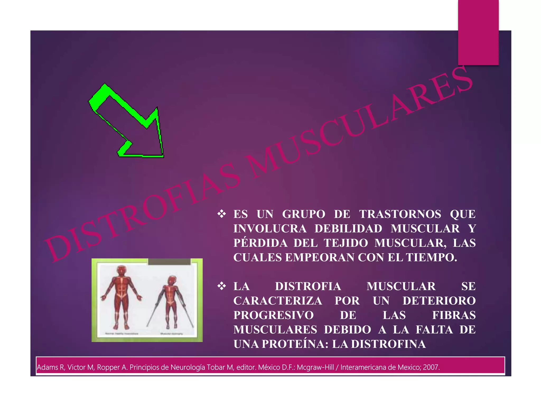 Distrofia muscular diapositivas | PPTX