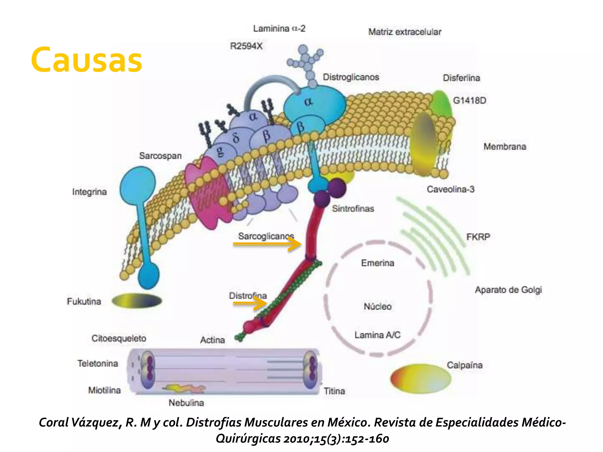 Distrofias Musculares | PPTX