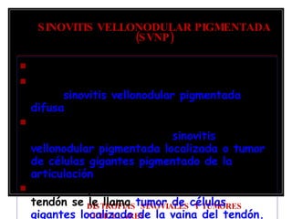 Distrofias Sinoviales Y Tumores Articulares | PPT