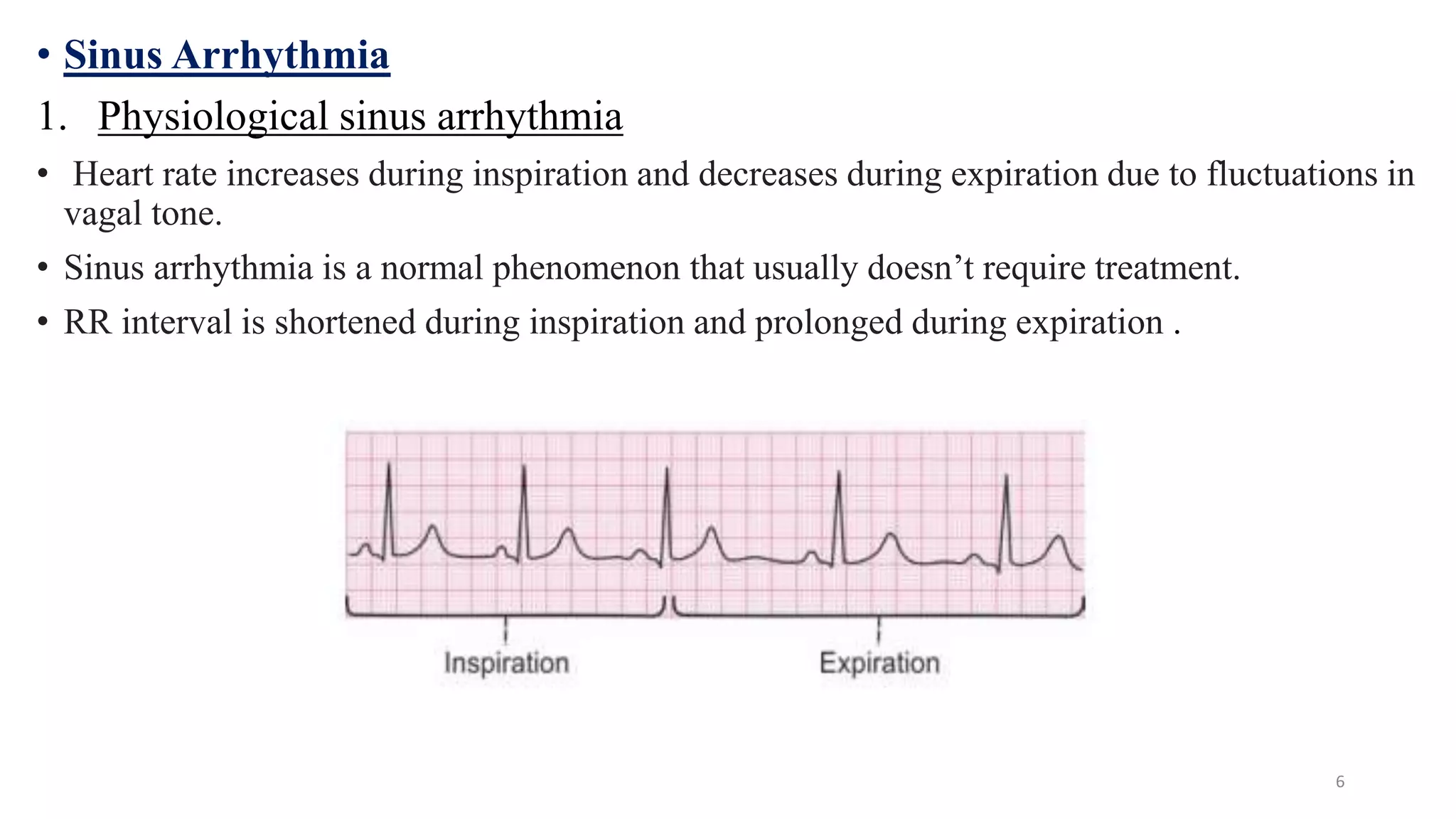 Disturbance of heart rhythm | PPTX