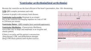 Disturbance of heart rhythm | PPTX