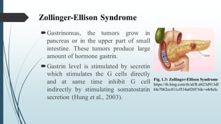 DISTURBANCES IN SECRETIN HORMONE Secretin | PPT