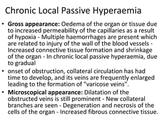 Disturbances of Circulation (Pathology) | PPTX