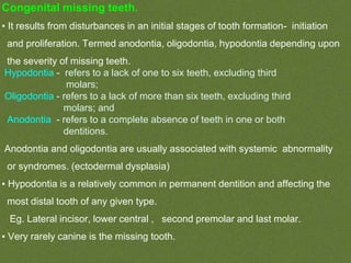 Disturbances of dental development | PPTX