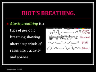 Ataxic Breathing