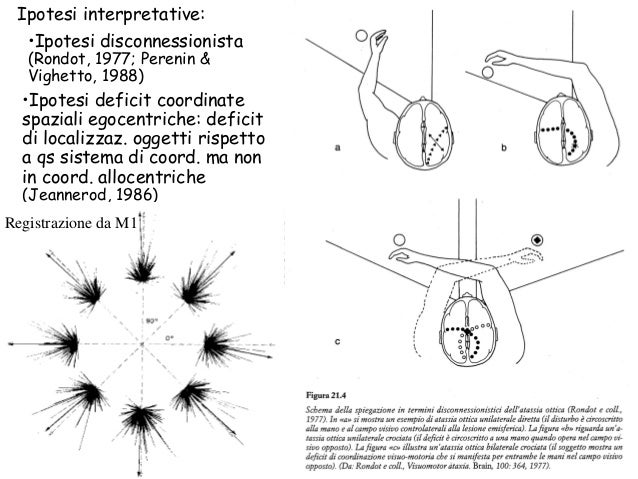 Disturbi Visuo Spaziali Aprassia C Atassia O Balint 11 12