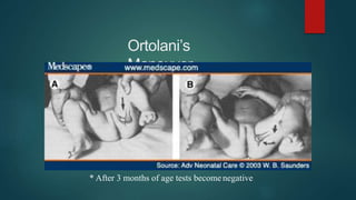 Developmental Dysplasia of Hip | PPTX | Death, Injury, or Military ...