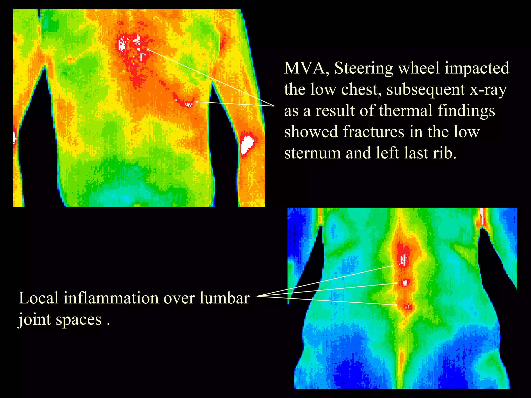 Thermal Imaging Powerpoint | PPT