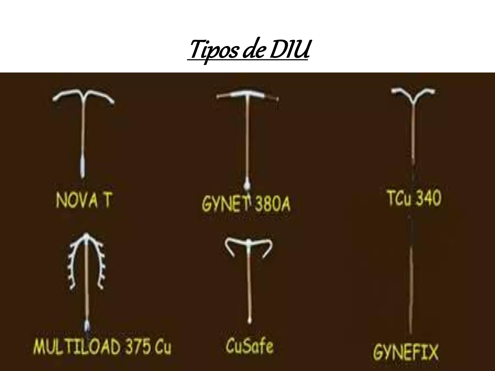 Dispositivo Intrauterino DIU