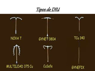 Dispositivo Intrauterino DIU | PPTX