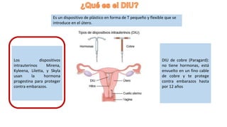 Diu mirena | PPTX