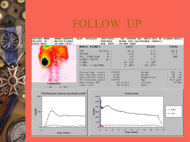 Diuretic renography | PPT | Endocrine and Metabolic Diseases | Diseases and Conditions