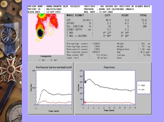 Diuretic renography | PPT | Endocrine and Metabolic Diseases | Diseases and Conditions